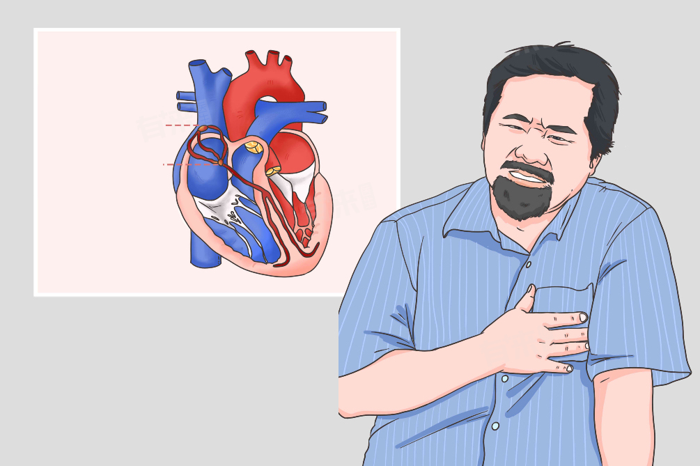 SDNN正常值范围及意义-有来医生